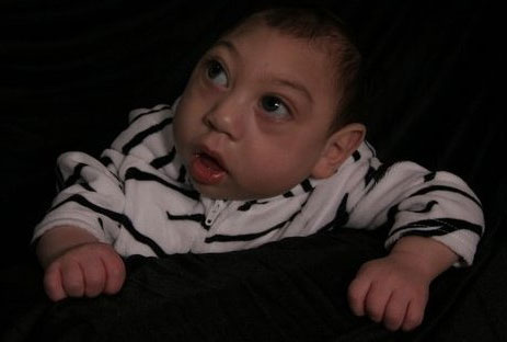 Nickolas Coke – Baby With No Brain Dies At Age 3 :: Today Outlook